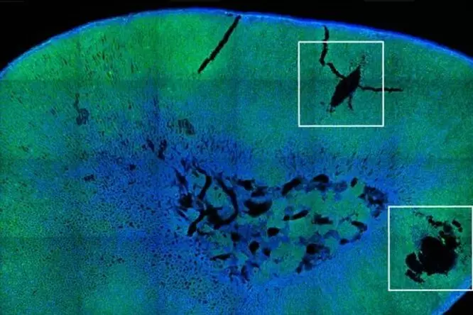 Ang magnetic nanoparticle nag-adjust sa lebel sa mga hormone sa stress 18475_2