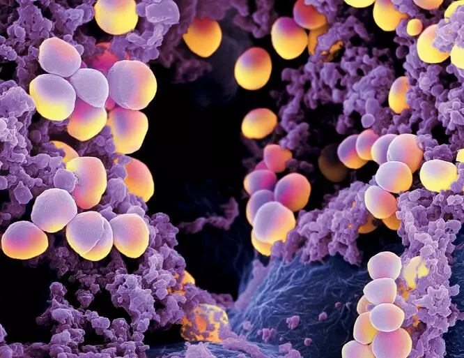 Staphylococcus aureus.