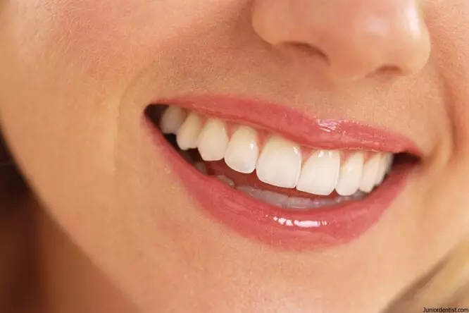 De tanden van mensen met de loop van de evolutie worden kleiner, terwijl de hersenen toenemen. Andere primes hebben een volledig omgekeerde foto. Trouwens, Fat Dental-enamel is ook alleen onze functie.