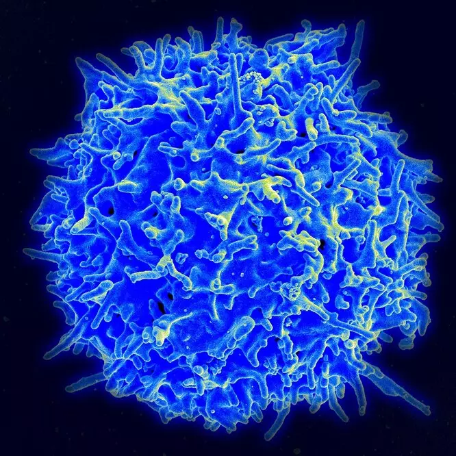 Reprogramming of cells - the way to get rid of cancer? 343000_4