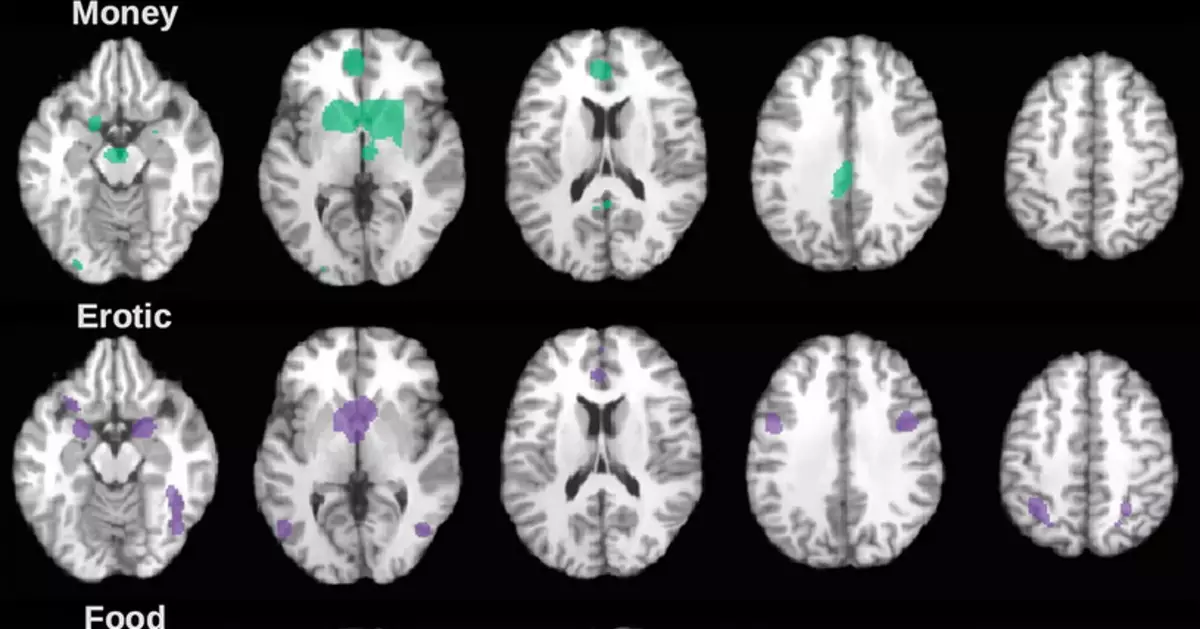 За задавальненне ад эротыкі, салодкага і грошай адказваюць розныя структуры мозгу